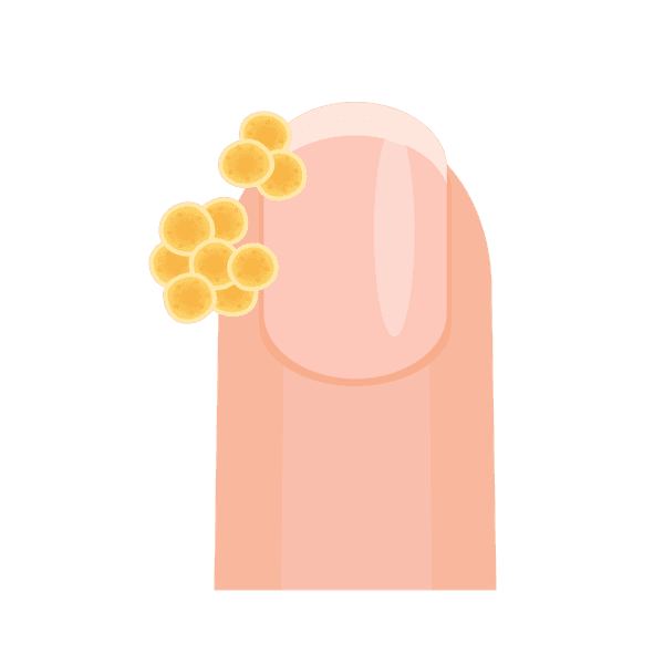 Vanliga frågor om PMS och PMDS - Doktera